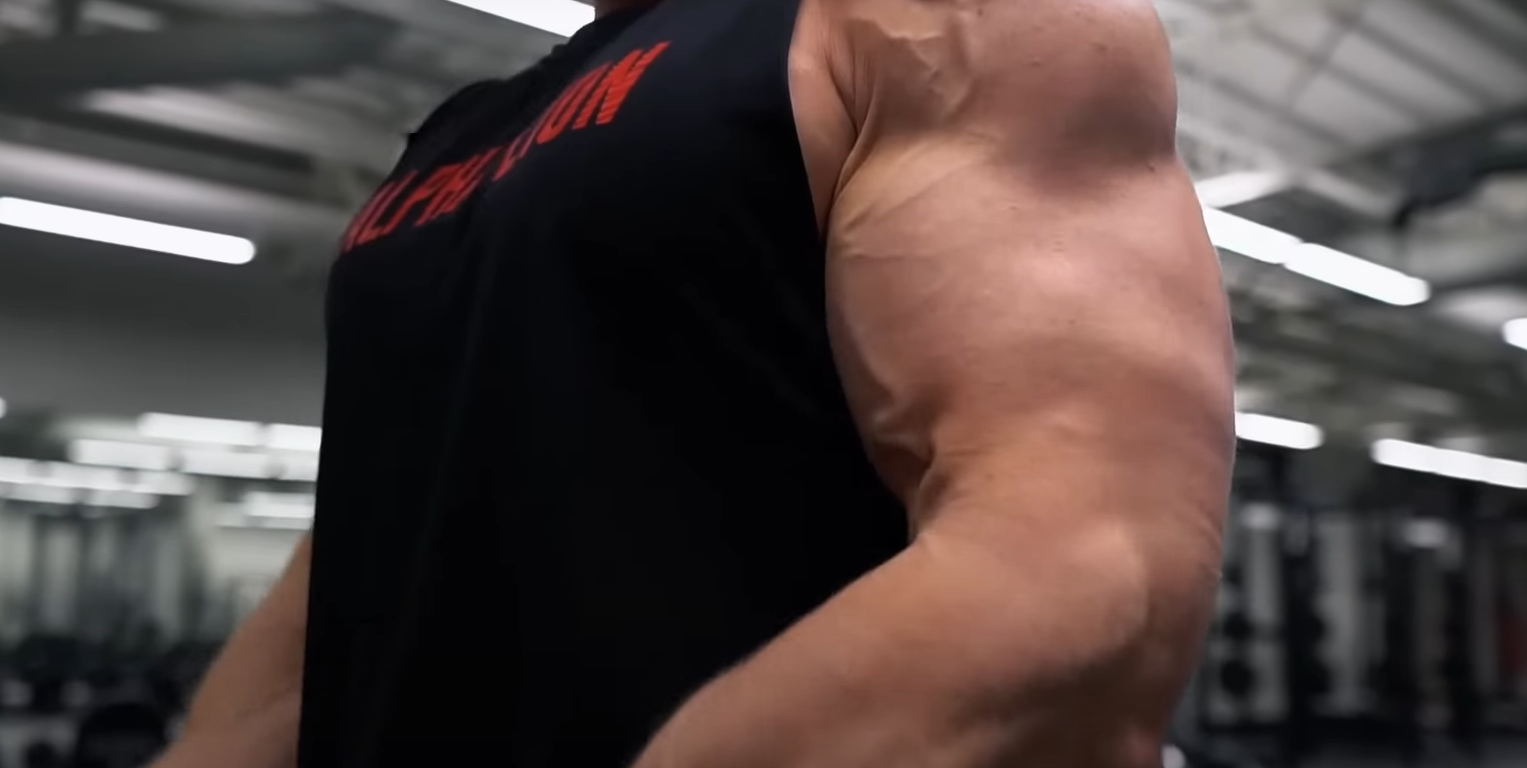 Cable Arm Workouts - Rio Linda Fitness